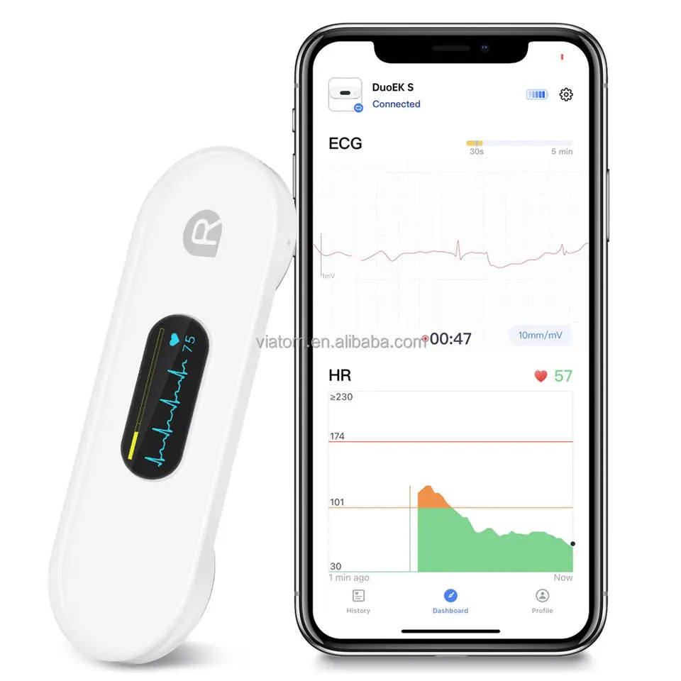 Portable EKG Device with Free App and AI Analysis – Stuffology Store